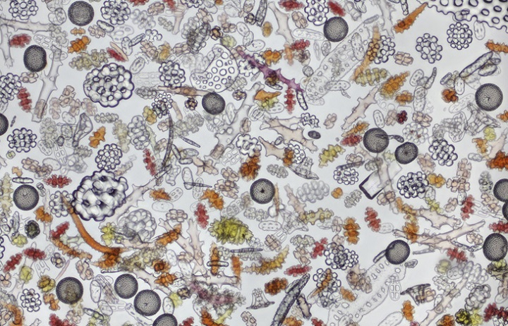 Sand Electron Microscope